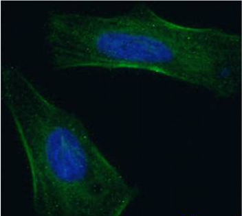 EGFR domain III Antibody [h-R3 (Nimotuzumab)], Rabbit IgG - Research ...