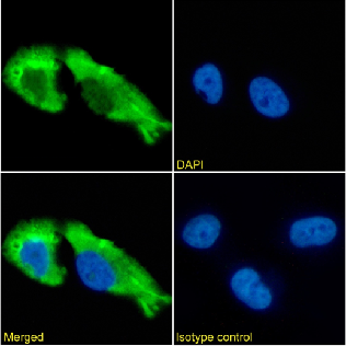 GABAR Antibody [1F4], Rabbit IgG | ProSci Incorporated