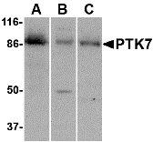 PTK7 Antibody - Cat. No. 4297 | ProSci
