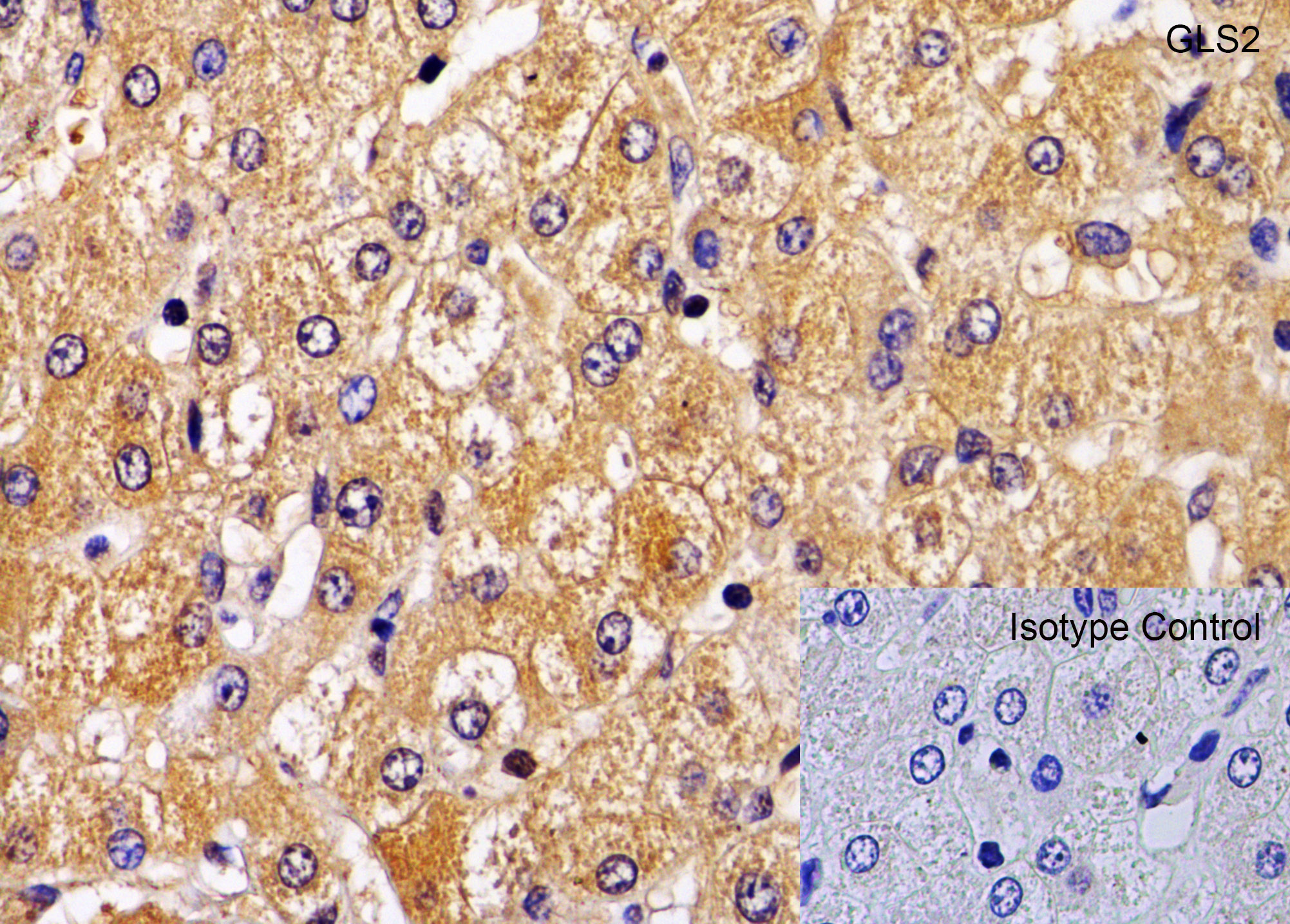 GLS2 Antibody - Cat. No. 6217 | ProSci