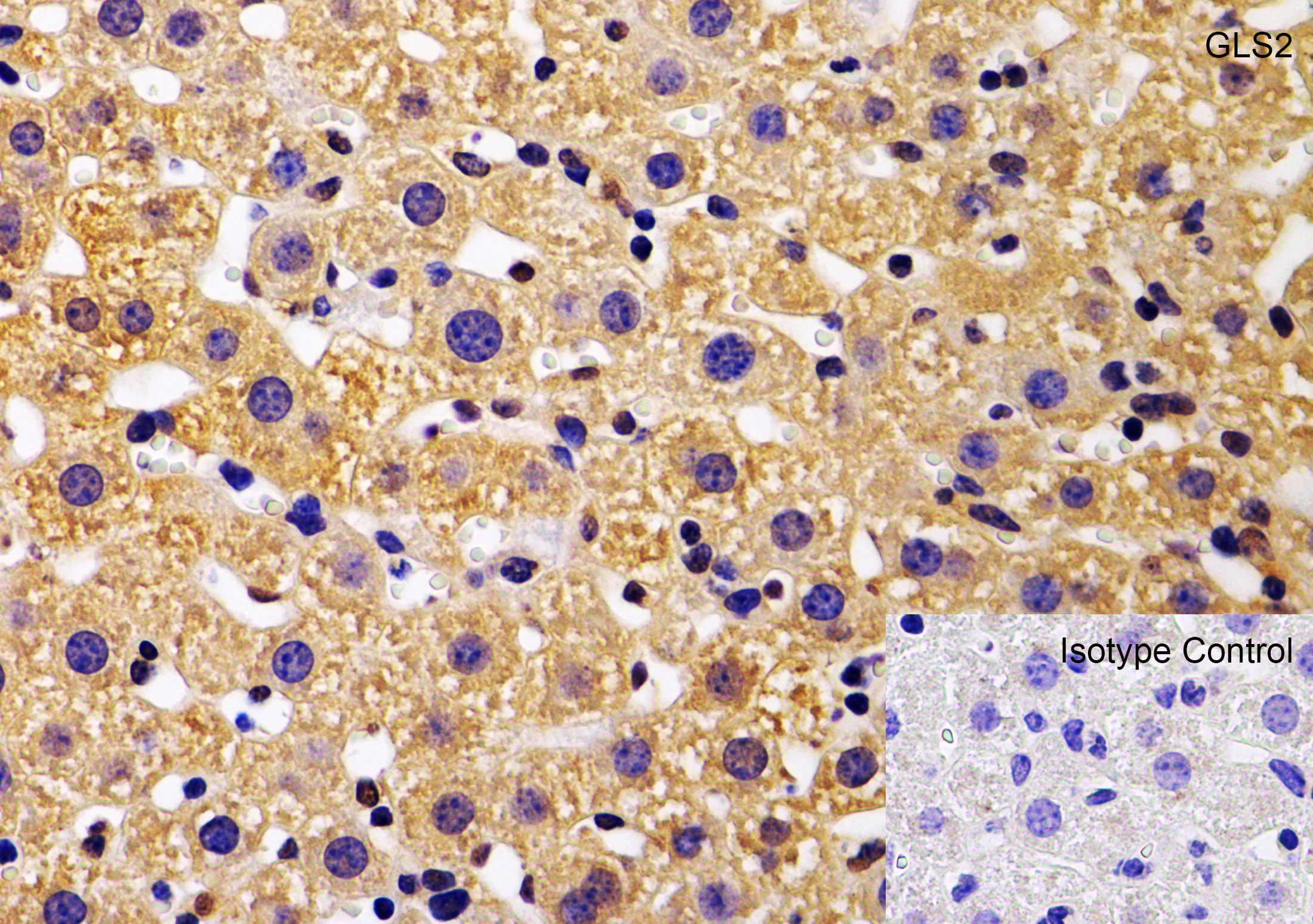 GLS2 Antibody - Cat. No. 6217 | ProSci