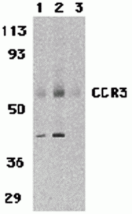 CCR3 Antibody - Cat. No. 1109 | ProSci