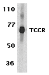 TCCR Antibody - Cat. No. 2481 | ProSci