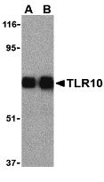 TLR10 Antibody - Cat. No. 3275 | ProSci