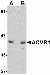 ACVR1 Antibody - Cat. No. 4791 | ProSci