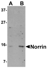 Norrin Antibody - Cat. No. 5119 | ProSci