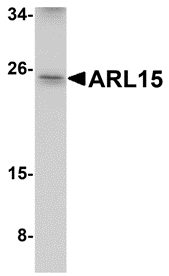 ARL15 Antibody - Cat. No. 5263 | ProSci