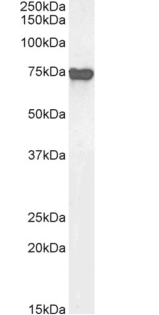 Alpha-fetoprotein (AFP) Antibody [AF5], Rabbit IgG | ProSci Incorporated