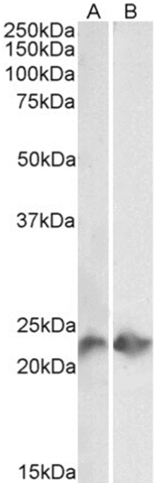 CD3 epsilon Antibody [UCHT1], Mouse IgG1 | ProSci Incorporated