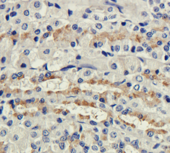 CD35 (complement receptor 1) Antibody [8C12], Rabbit IgG | ProSci ...
