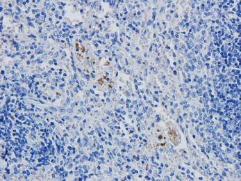 CD4 Antibody [YNB46.1.8 (Campath-9H)], Rat IgG1 | ProSci Incorporated