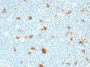 Calgranulin A + B Antibody [CAGB/426] - Cat. No. 33-461 | ProSci