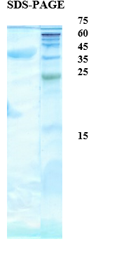 Penicillium notatum allergen Pen n 18 Recombinant Protein | ProSci ...