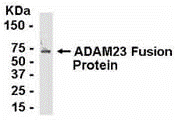 ADAM23 Antibody - Cat. No. XW-7809 | ProSci