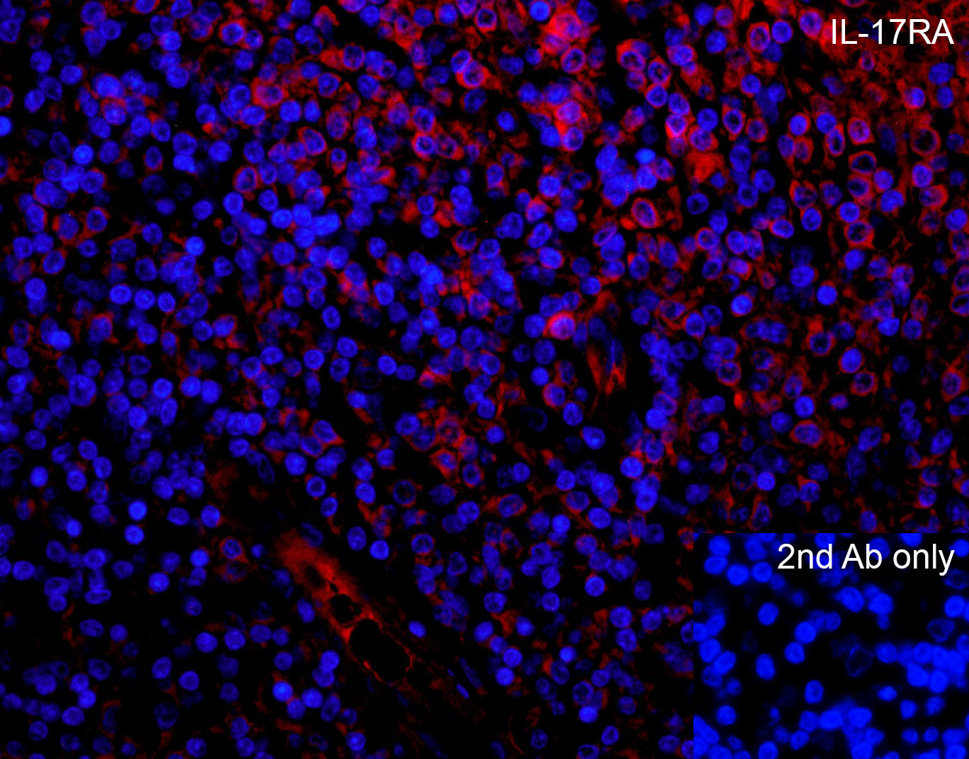 IL-17RA Antibody - Cat. No. 7419 | ProSci