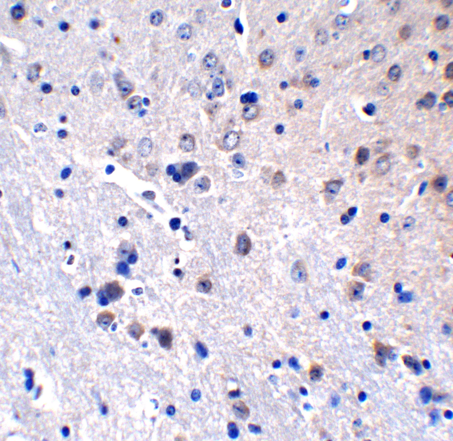 ZBP1 Antibody - Cat. No. 4401 | ProSci