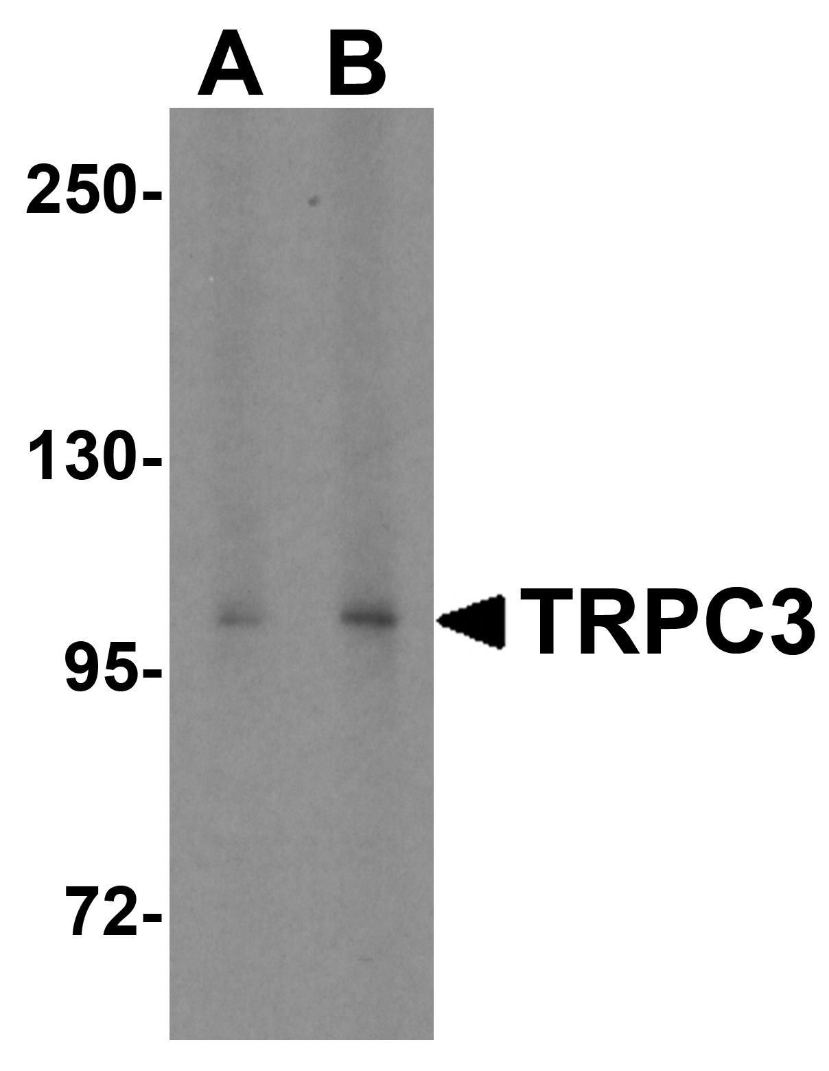 TRPC3 Antibody - Cat. No. 3895 | ProSci
